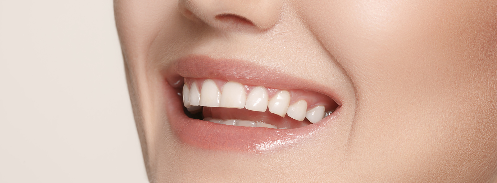 Zoom Teeth Whitening Simi Valley